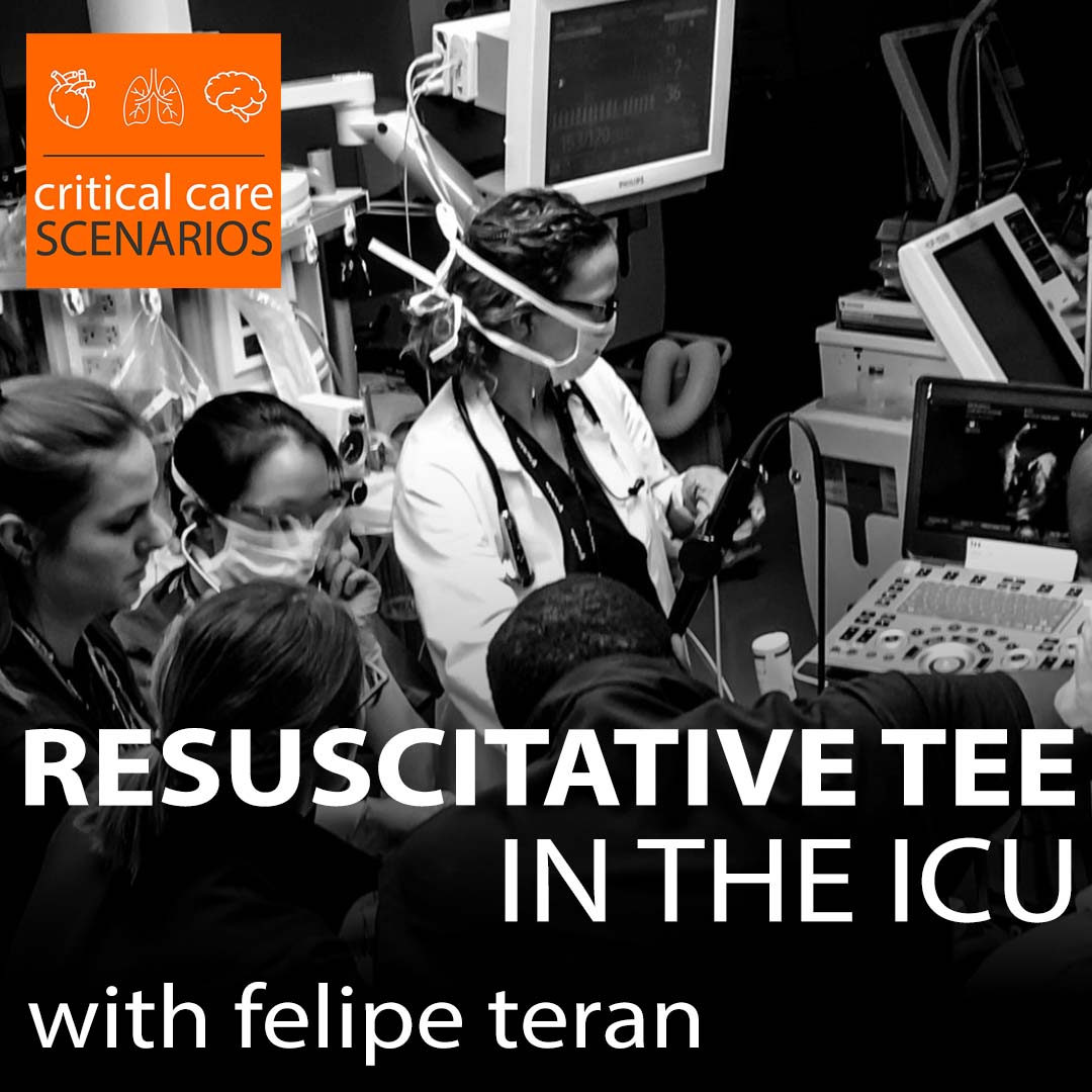 Episode 43: Resuscitative TEE with Felipe Teran – Critical Care Scenarios