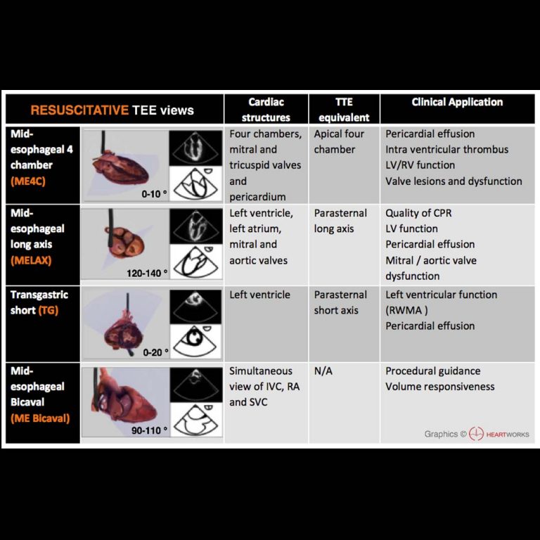 Episode 43: Resuscitative TEE with Felipe Teran – Critical Care Scenarios