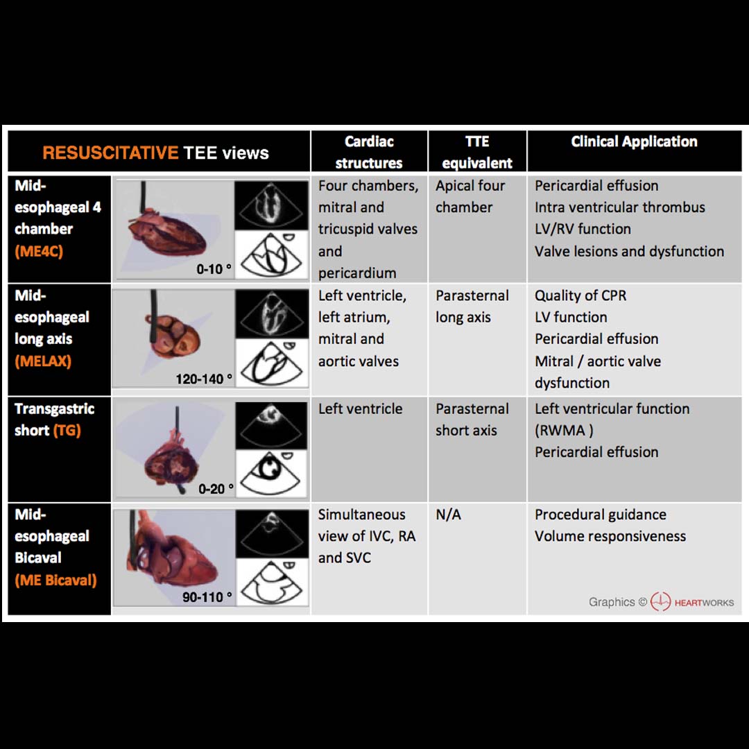 Episode 43: Resuscitative TEE with Felipe Teran – Critical Care Scenarios